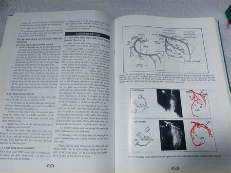 BỆNH HỌC TIM MẠCH tập