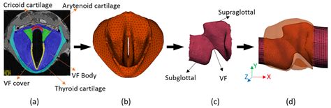 Subject Specific Computational Fluid Structure Interaction Modeling Of