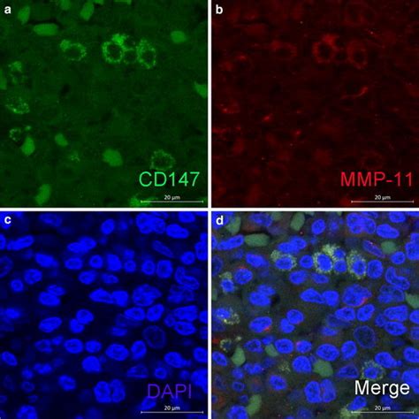 Representative Photomicrographs Of Double Fluorescent Staining Of Cd147