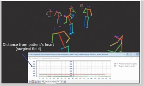 Rohit Singh On Linkedin Artificialintelligence Machinelearning