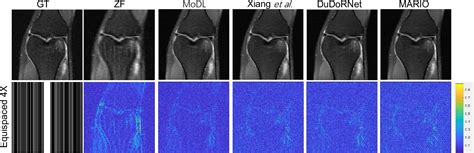 Figure 4 From Deep Multi Modal Aggregation Network For Mr Image Reconstruction With Auxiliary
