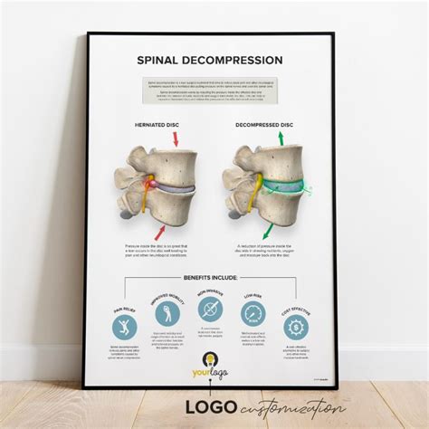 Spinal Decompression Poster Kirografiks