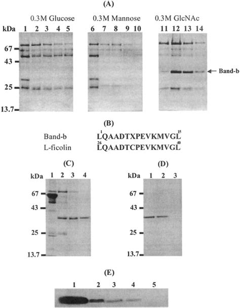 Human Mannose Binding Lectin And L Ficolin Function As Specific Pattern Recognition Proteins In