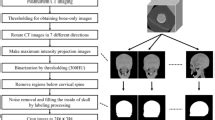 Deep Learning Versus Human Assessors Forensic Sex Estimation From Three Dimensional Computed