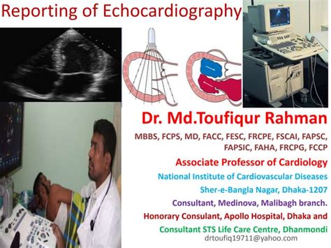 Echo Reporting Basics Ppsx Heart And Cardiovascular Diseases Diseases And Conditions Echo Reporting Basics Ppsx Heart And Cardiovascular Diseases Diseases And Conditions
