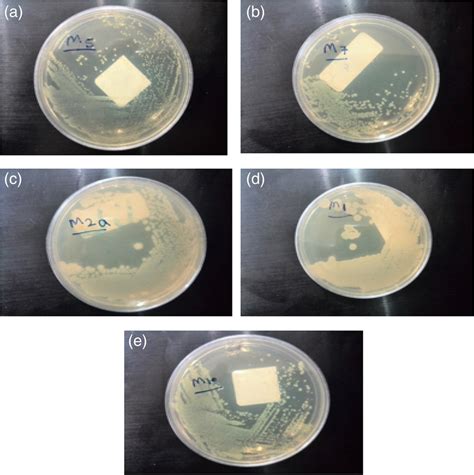 Photographs Of Bacteria Identified To Degrade Ao7 Dye A Bacillus