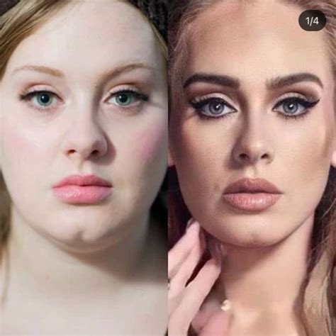 The Gorgeous And Talented Adele Adele Before And After Celebrity Plastic Surgery Talent