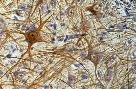 Brain Tissue Stock Image P3600127 Science Photo Library