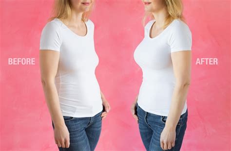 Mujer Antes Y Después De La Cirugía Plástica De Aumento De Senos Foto