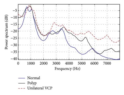A Average Linear Prediction Lp Spectrum And B Spectral Difference