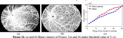Hierarchical Method For Cataract Grading Based On Retinal Images Using Improved Haar Wavelet