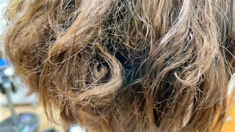 완전망한머리 복구클리닉으로 소생하다 네이버 Tv