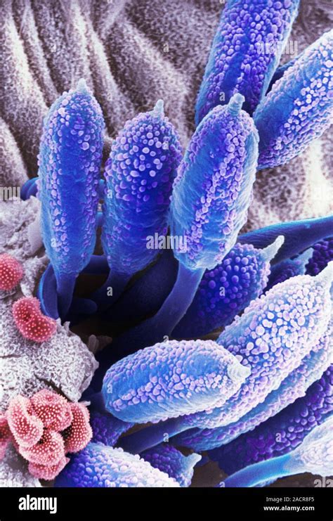 Rust Fungus On A Rose Leaf Coloured Scanning Electron Micrograph SEM Of Rust Fungus