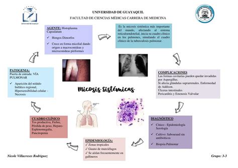 Micosis Sistémicas