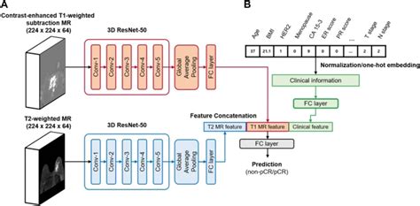 Multimodal Deep Learning In Breast Cancer Classification Aiml Insights