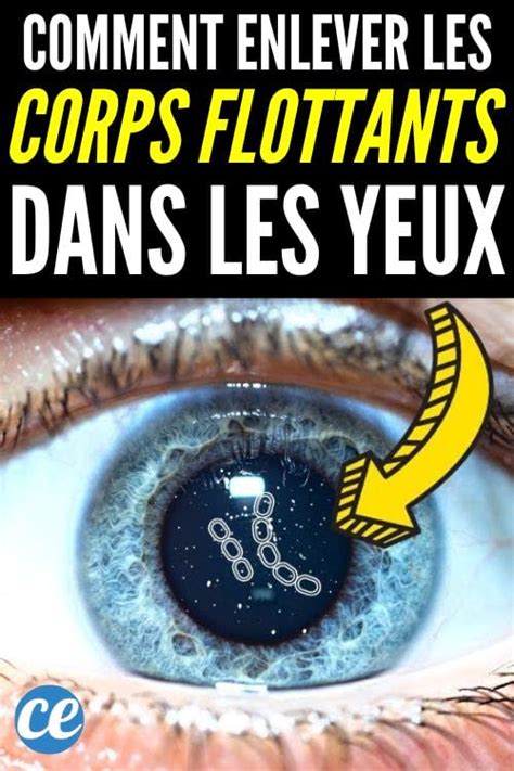 pourquoi je vois des corps flottants devant mes yeux et comment les