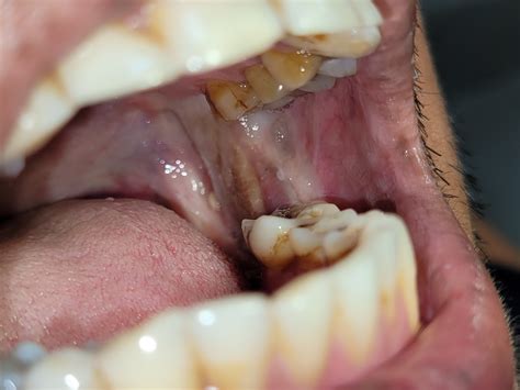 Osmf Object Detection Dataset And Pre Trained Model By Icmr Sts