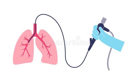 Bronchoscopy Procedure Concept Stock Vector Illustration Of Disease