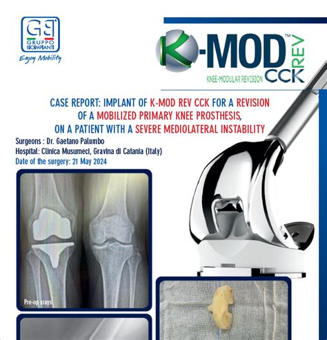 K Mod Rev Cck New Case Report Gruppo Bioimpianti
