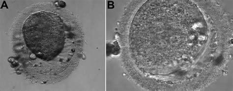 A Oocyte In Metaphase Ii B Oocyte Mii Fertilized With 04 Pronuclei Download Scientific