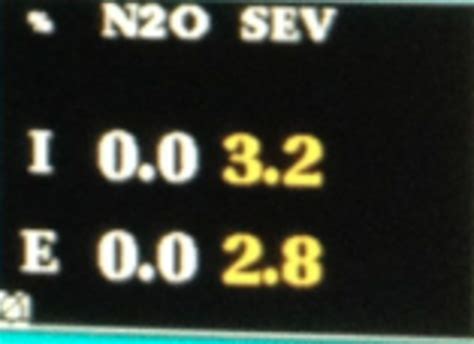 Patient Monitoring During Anesthesia Owlcation