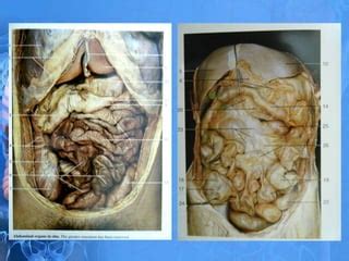 Anatomy Of Appendix PPT Digestive Disorders Diseases And Conditions