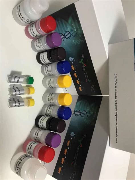 人硫酸软骨素 Cs）elisa试剂盒 上海双赢生物科技有限公司 耗材产品 阿仪网