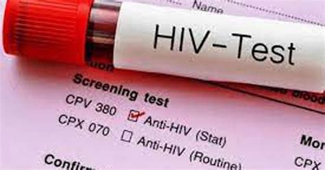 Owwa Eyes Inclusion Of Hiv In Pdos
