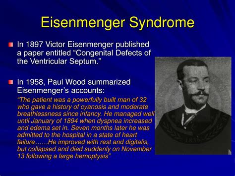 Ppt Congenital Heart Diseases Ii Powerpoint Presentation Free