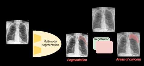 vision language multimodal models could help physicians analyse