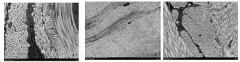 Observation Of Guinea Pig Sclera Under An Electron Microscope × 4000