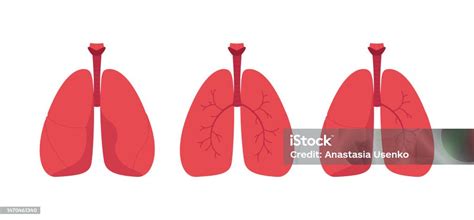 인간의 폐 해부학 개념 벡터 플랫 의료 그림 세트입니다 흰색 배경에 혈관이 있는 빨간색 건강한 폐 건강 관리 교육 폐병학을 위한 디자인 요소 기도학에 대한 스톡 벡터 아트