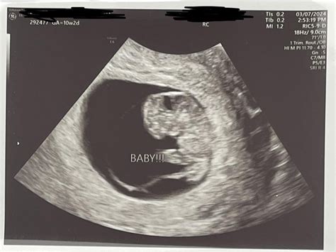 First Scan R Predaddit