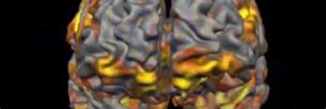 Creativity Emerges From Spontaneous Neural Activity