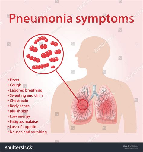 Pneumonia Symptoms Image Human Body Lungs Stock Vector Royalty Free