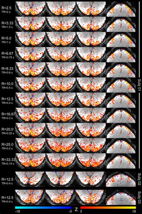 Activation Maps Highlighting Activation In Visual And Motor Cortex Download Scientific Diagram