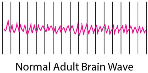 Image Recording Brain Activity Msd Manual Consumer Version