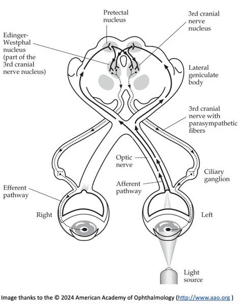 Pupil Abnormalities Mind The Bleep