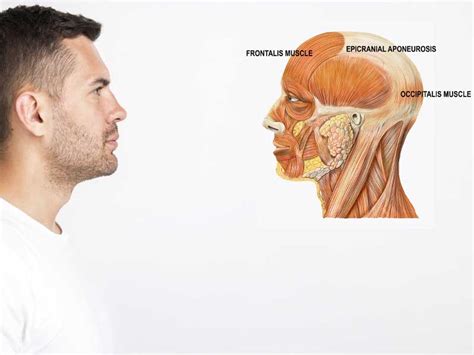 Galea Aponeurotica Hair Loss Link And Galeatomy Fix