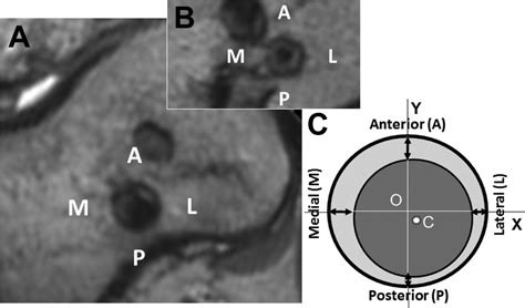 Using Imagej To Measure Cell Number And Crosssectional