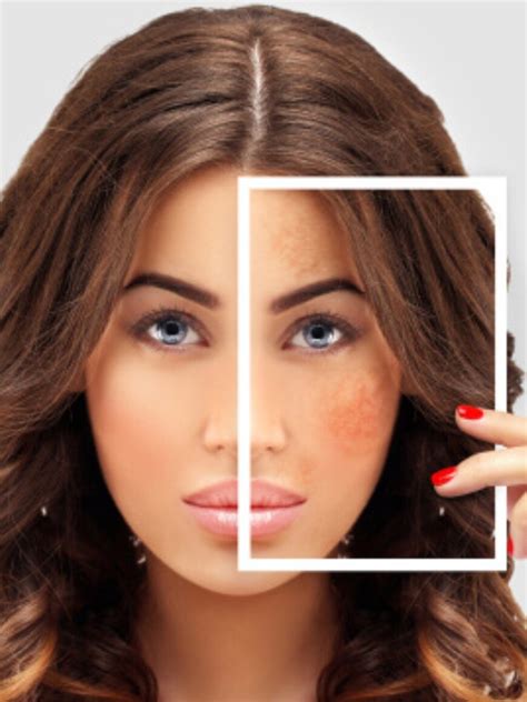 Pigmentation Skin Care Tips Sus Pigmentation Skin Care Tips Sus