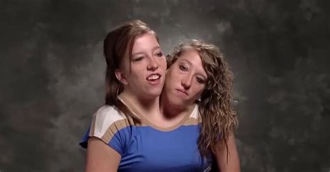 La Inspiradora Vida De Las Siamesas Abby Y Brittany Hensel Una Historia Que Desafía Los Límites