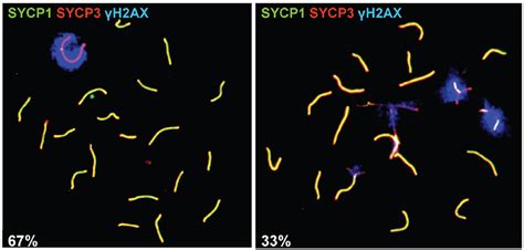 Sex Body Formation In The Prdm9 Pwd 2 F 1 Hybrid Male Surface Spread
