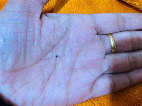 Mole On Palm Meaning Hatheli Par Til Ka Nishan Hai Hath Me Til Ka Matlab Hatheli Par Til Hona