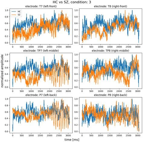 GitHub Cgpayne Electropsychographer A Machine Learning Model To Predict Whether Or Not A