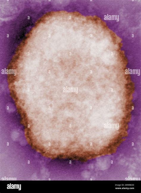 Highly Magnified Negative Stain Transmission Electron Micrograph Tem