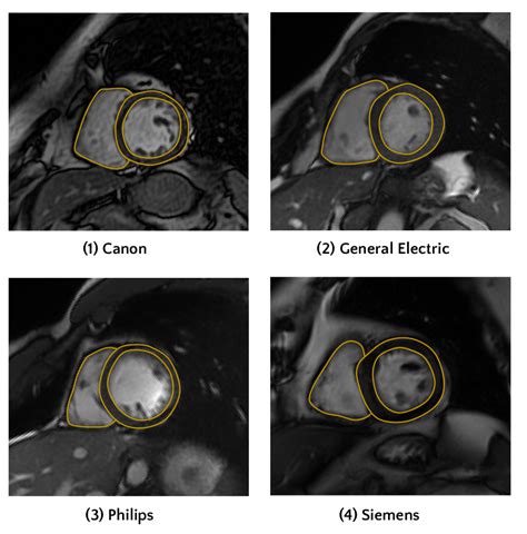 Multi Centre Multi Vendor And Multi Disease Cardiac Image Segmentation Challenge Eucanshare