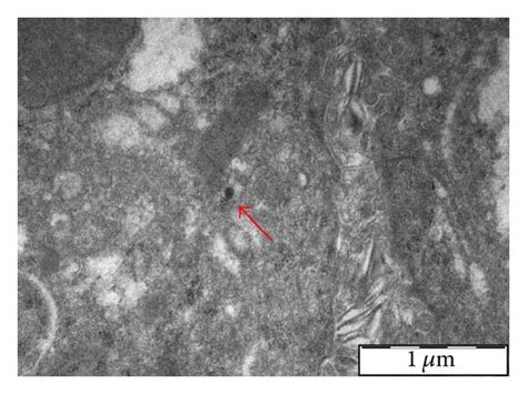 Electron Micrographs Of Liver Ultrathin Sections Of Negative Controls