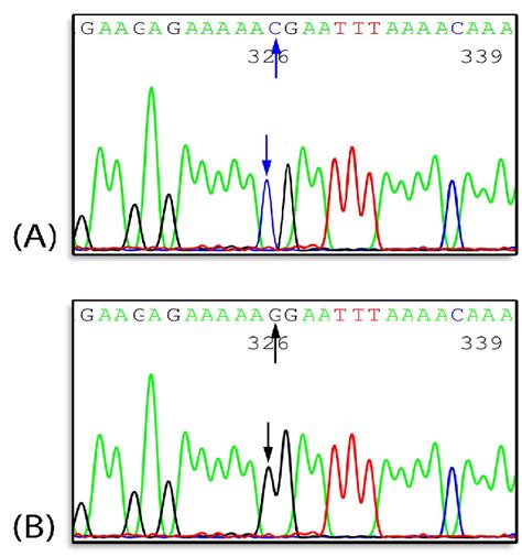 A Missense Mutation C 2645g C In Exon 23 Dnmt3a With Substitution Of Download Scientific