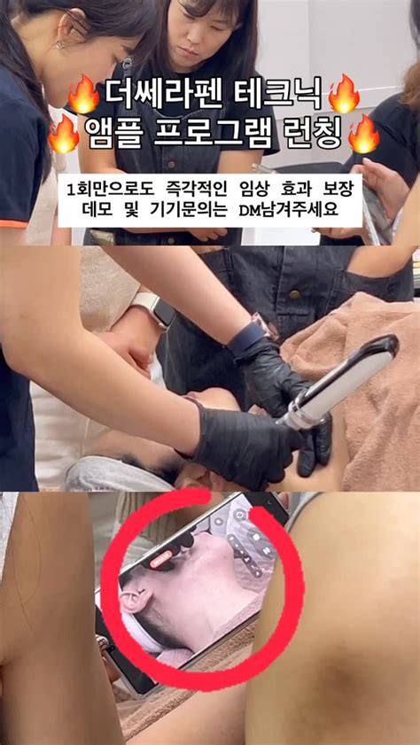메디코스니컬 브랜드 더쎄라 공식 계정 🟠20250623월 런칭🟠 1회만으로도 즉각적인 임상사진 다수 보유 No